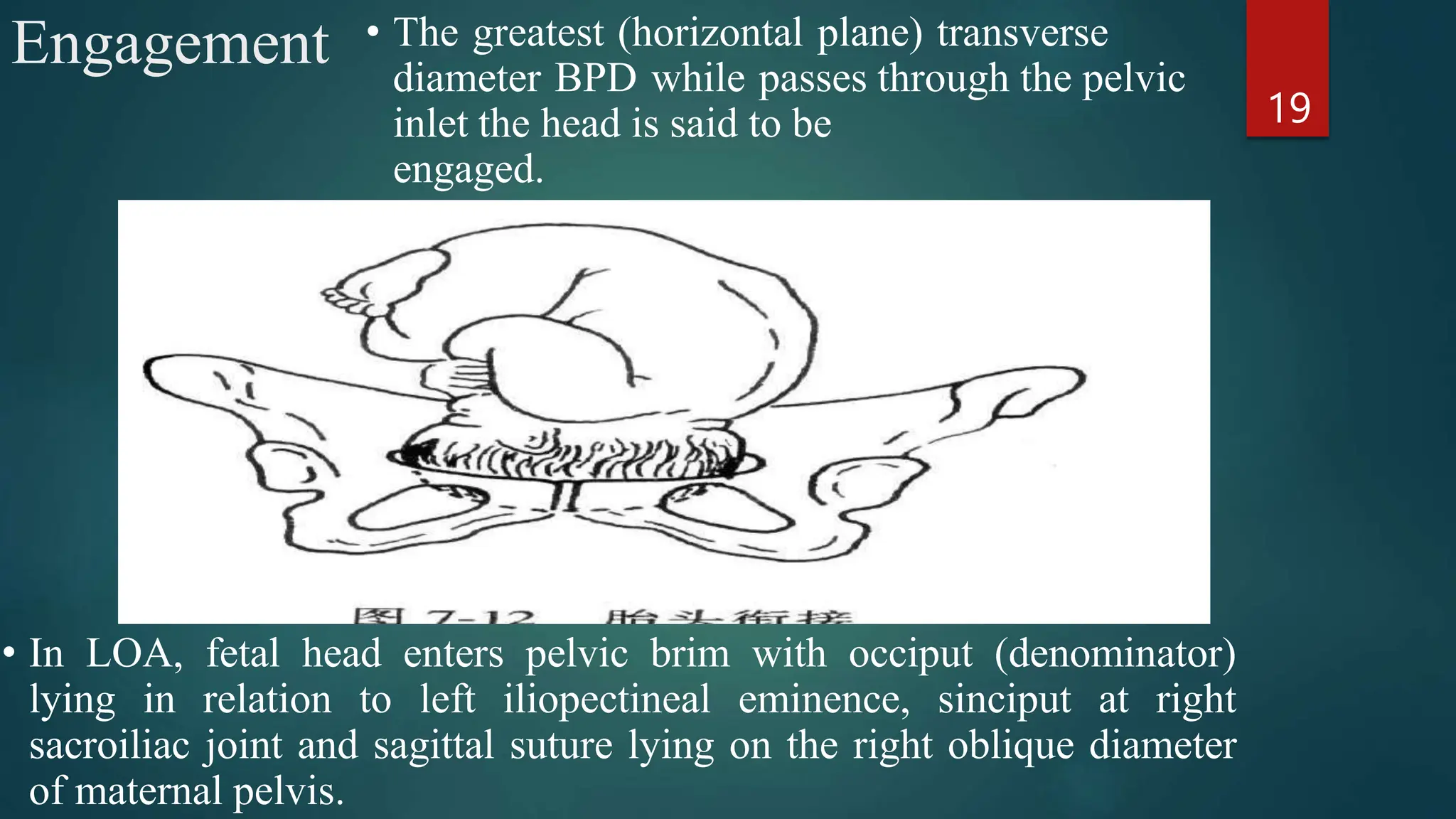 Mechanism of normal labour. Types of female pelvis.pptx