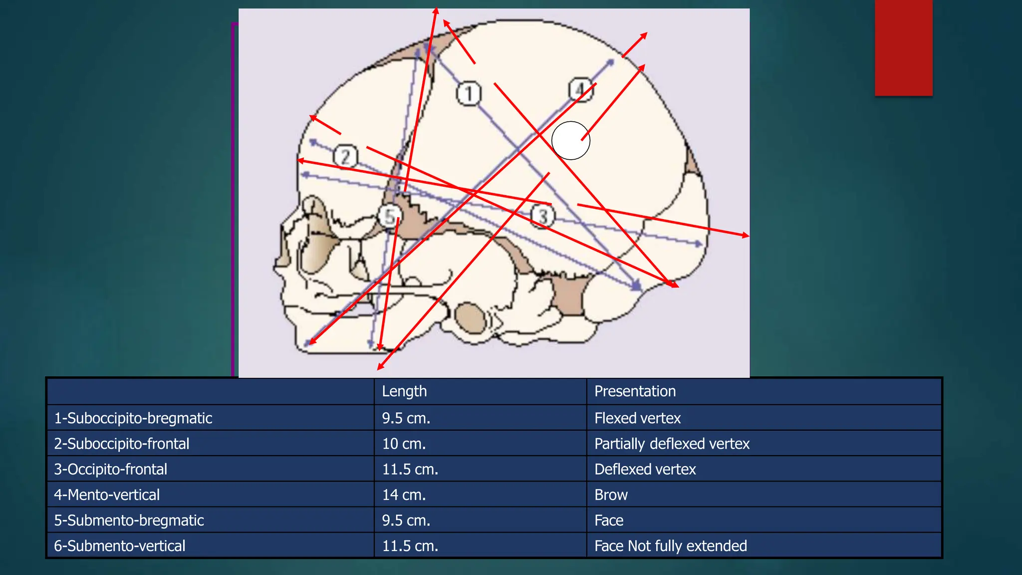 Mechanism of normal labour. Types of female pelvis.pptx