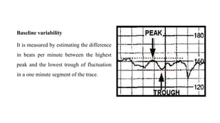 Gyneco. D. Ezdehar L5 Fetal Assessment in Labor.pptx