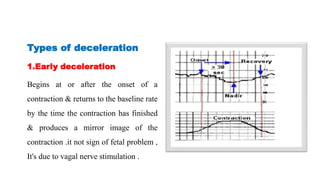 Gyneco. D. Ezdehar L5 Fetal Assessment in Labor.pptx