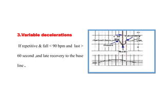 Gyneco. D. Ezdehar L5 Fetal Assessment in Labor.pptx