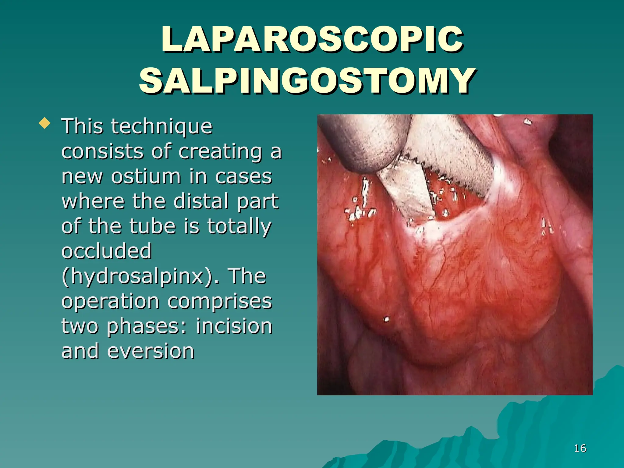 Gynecological Laparoscopy powerpoint slide | PPT