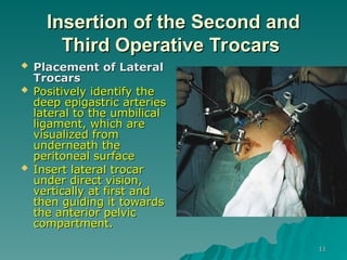 Gynecological Laparoscopy powerpoint slide | PPT