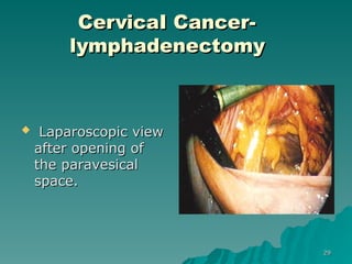 Gynecological Laparoscopy powerpoint slide | PPT