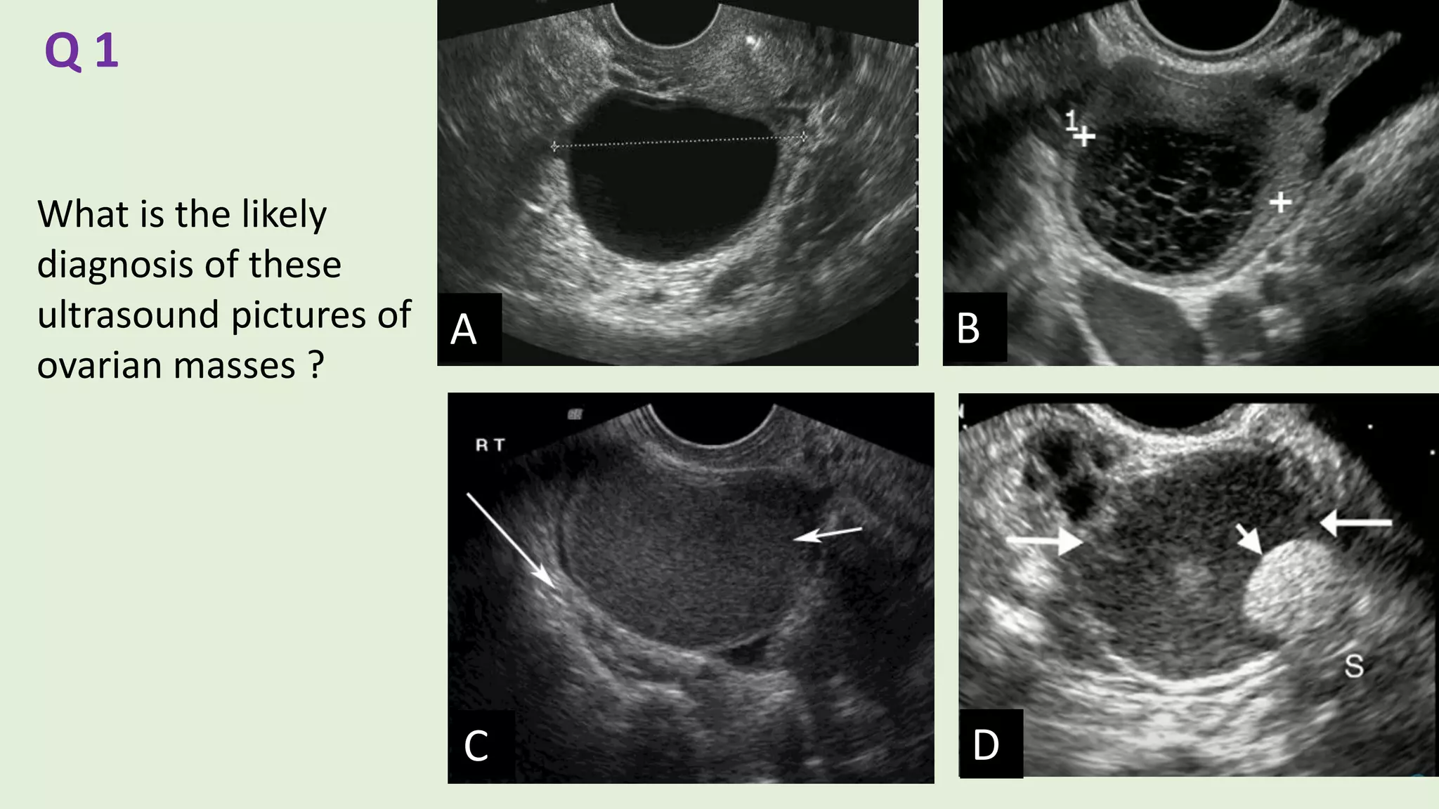 Gynecologic imaging - OSCE.pdf