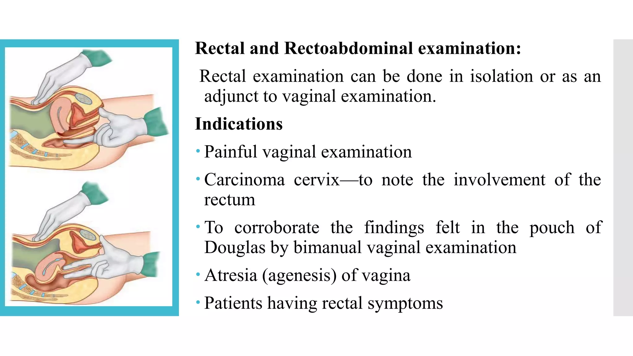 Gynecologocal assessment | PPTX