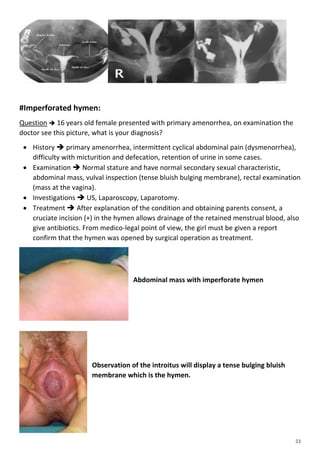 Gynecology | PDF