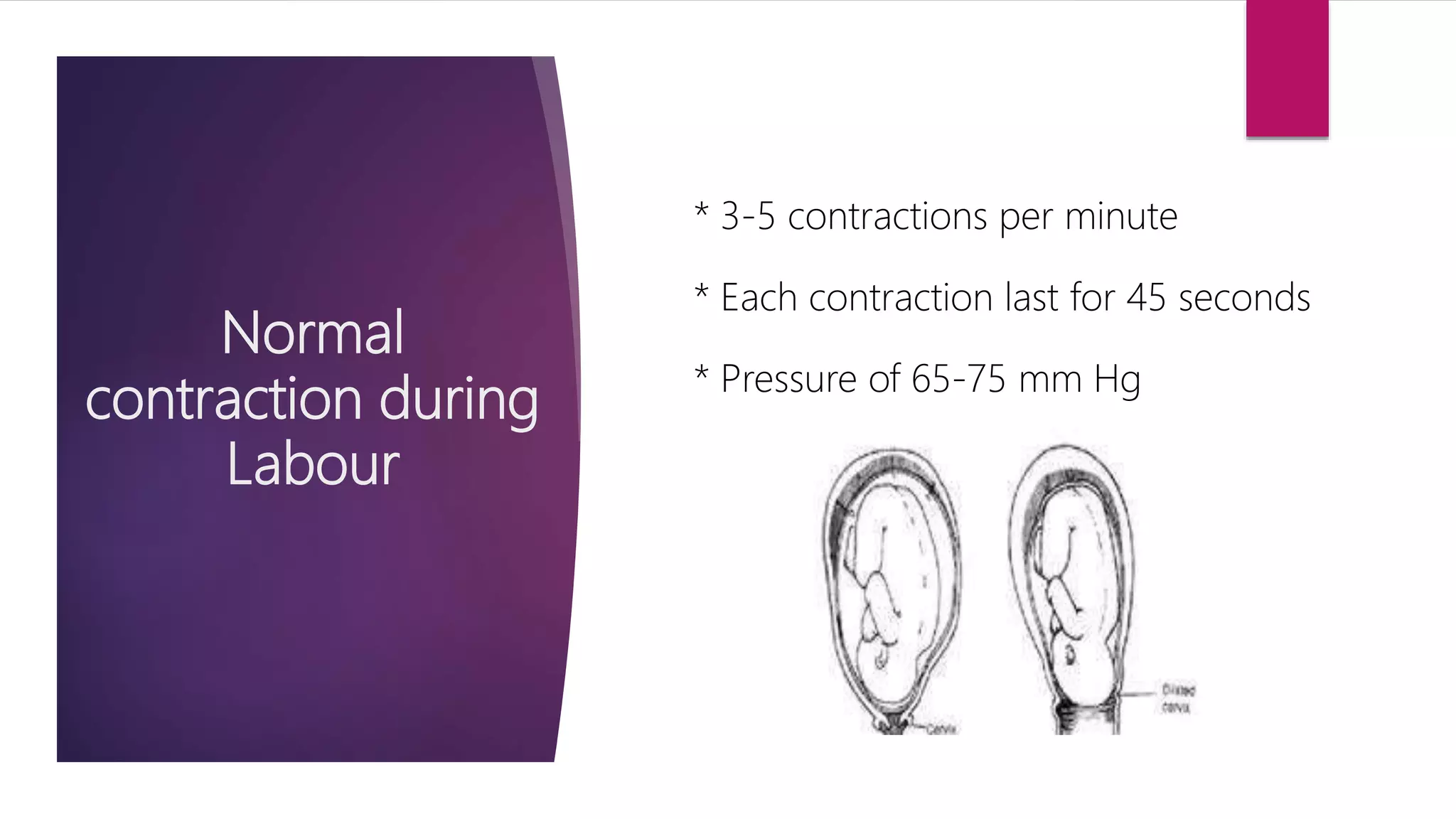 Labour and Delivery... Stages of labour.pptx