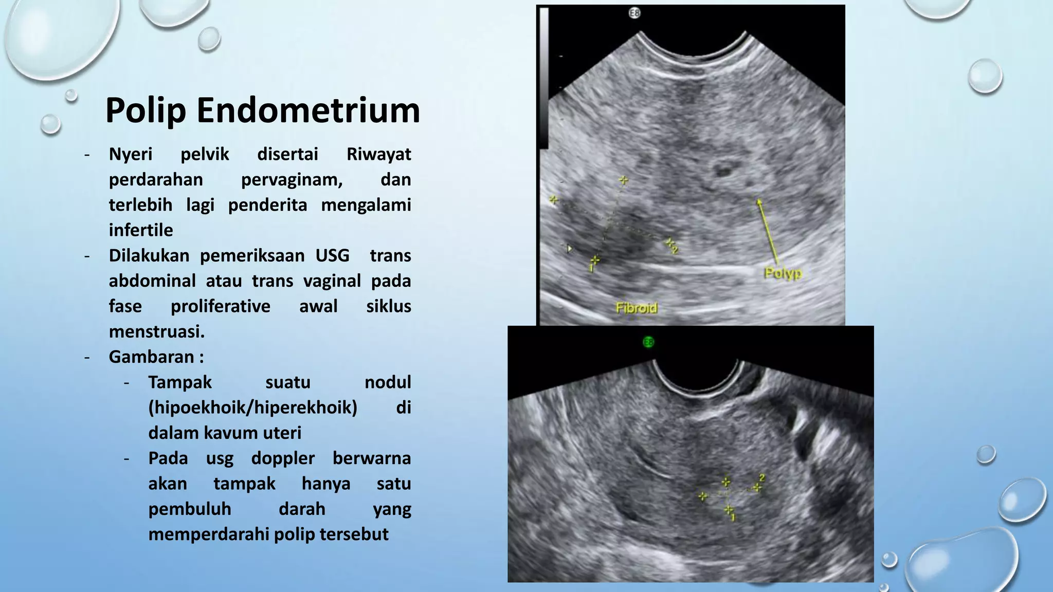 Gynecology Ultrasound---.pptx