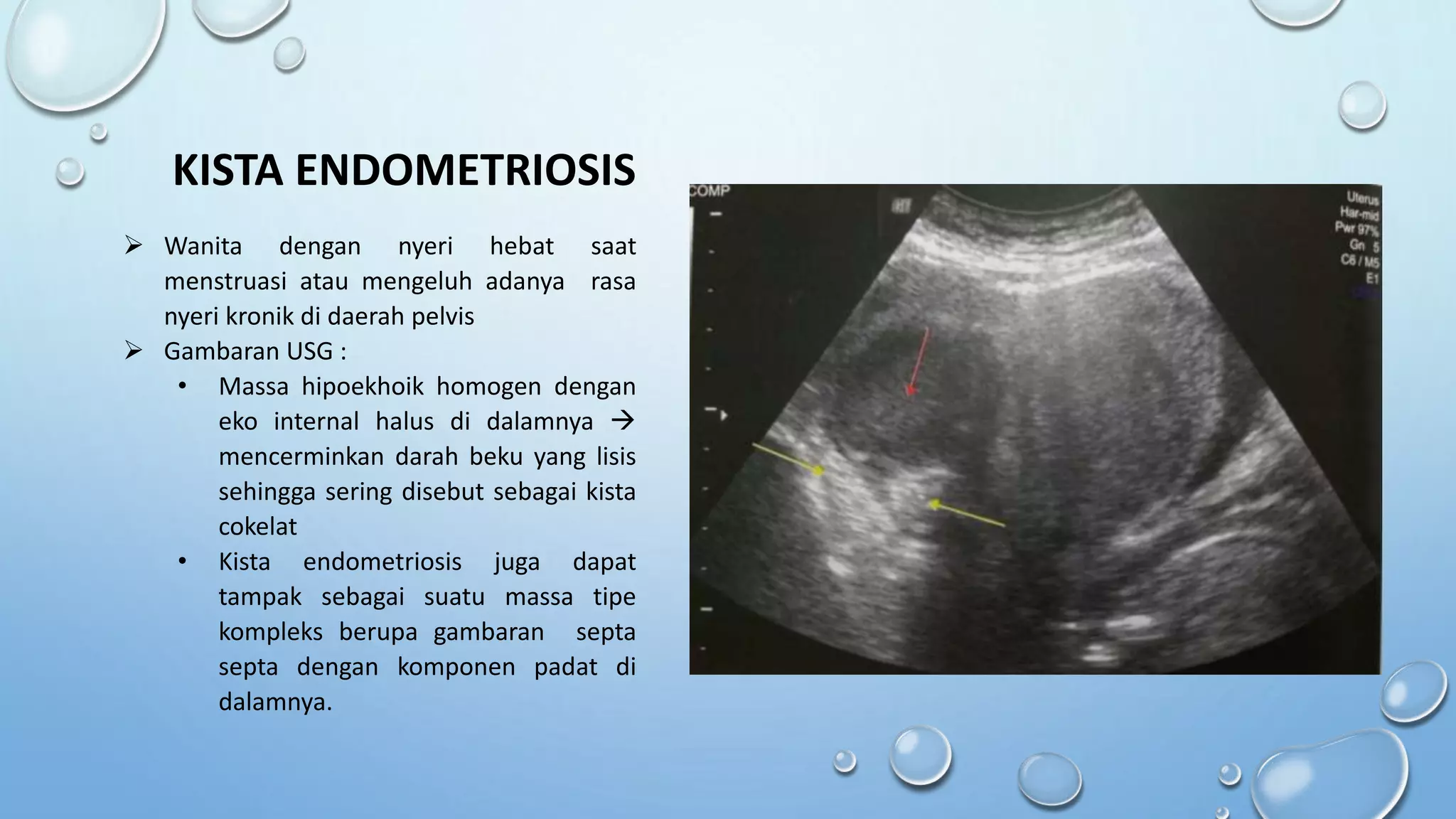 Gynecology Ultrasound---.pptx