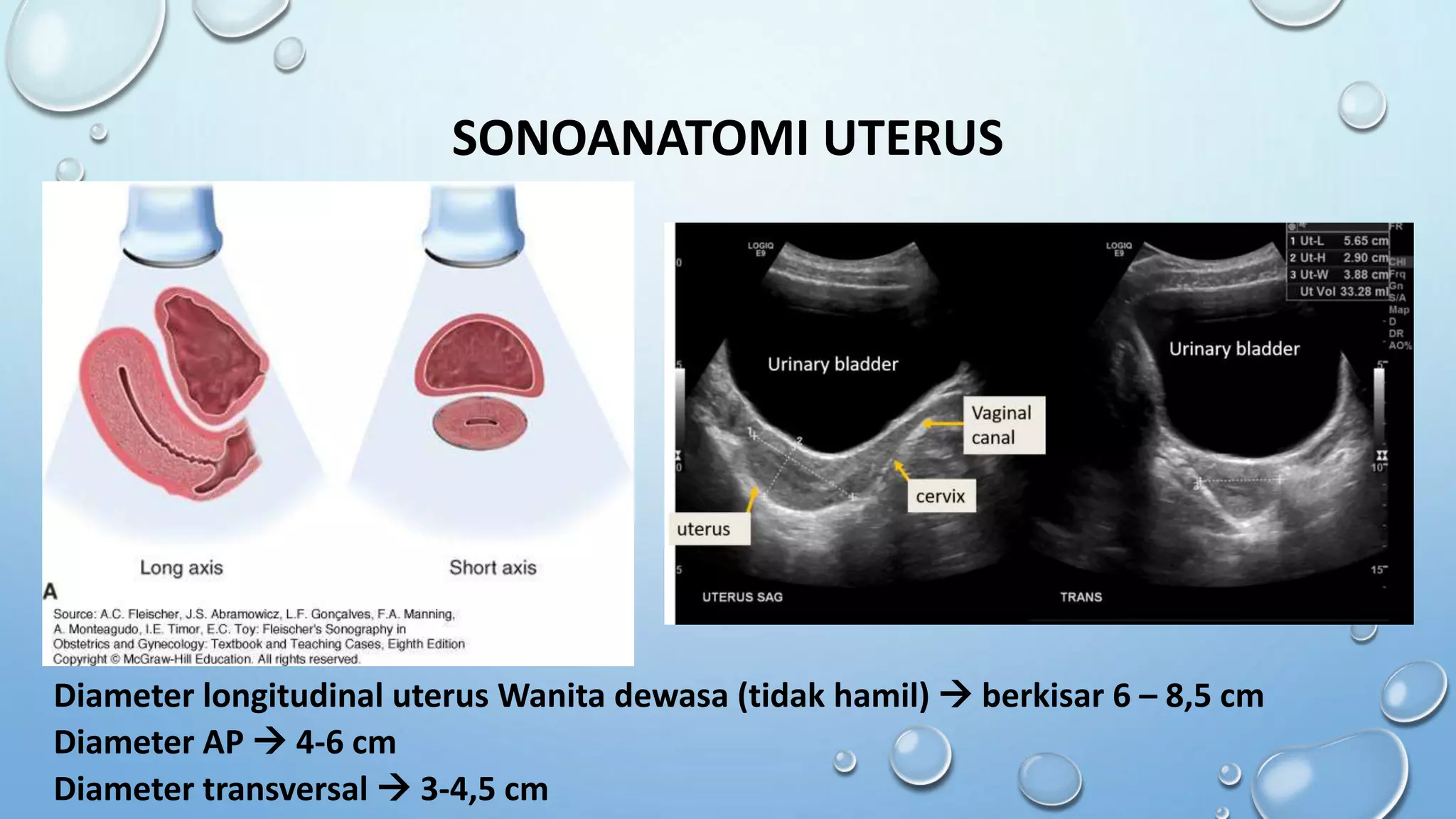 Gynecology Ultrasound---.pptx