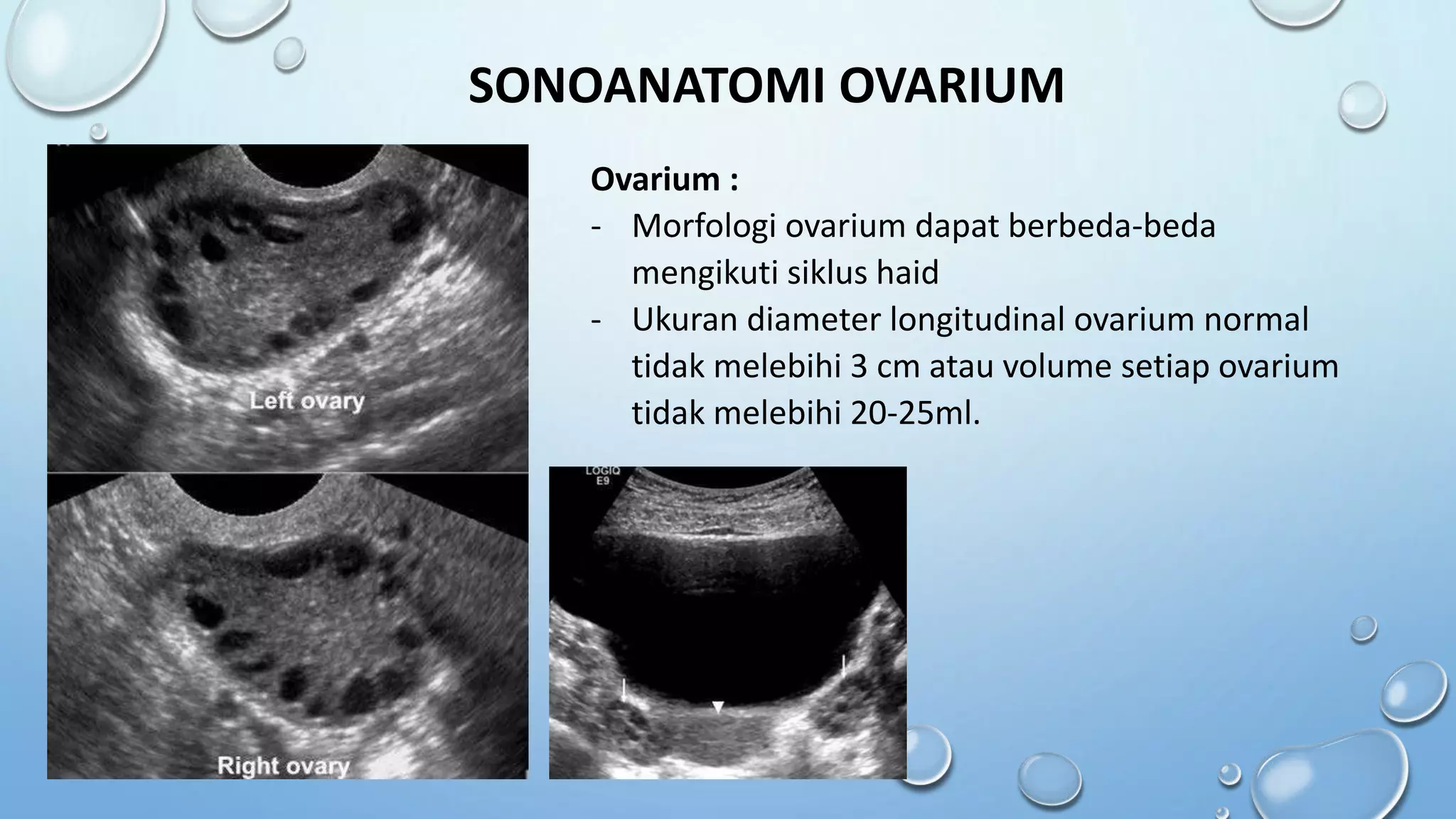Gynecology Ultrasound---.pptx