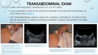 Gynecology Ultrasound---.pptx
