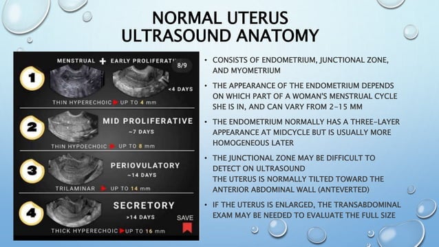 Gynecology Ultrasound---.pptx