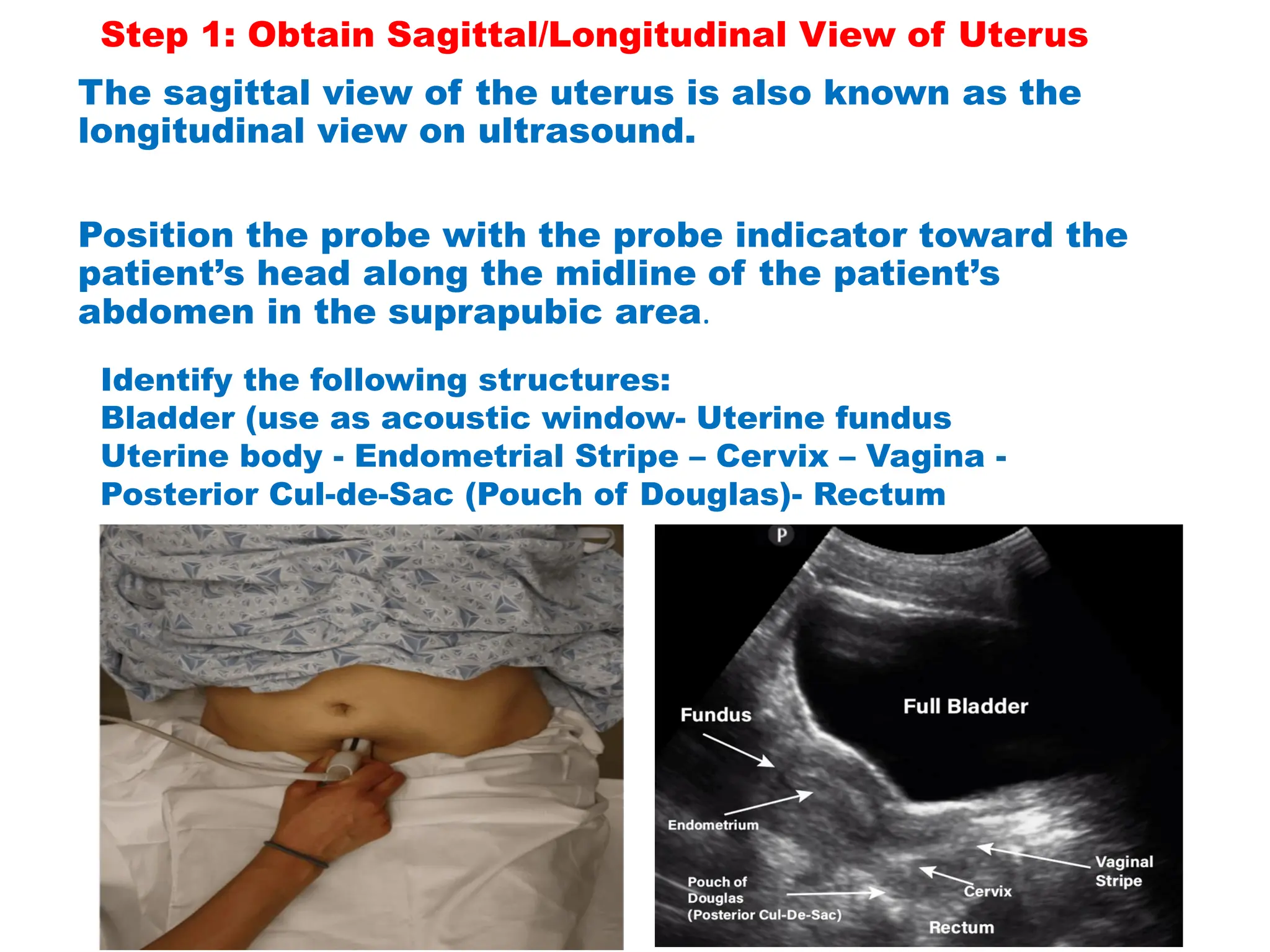 Gynecology Ultrasound PDF 11 (1). female pelvic ultrasound pdf | PDF