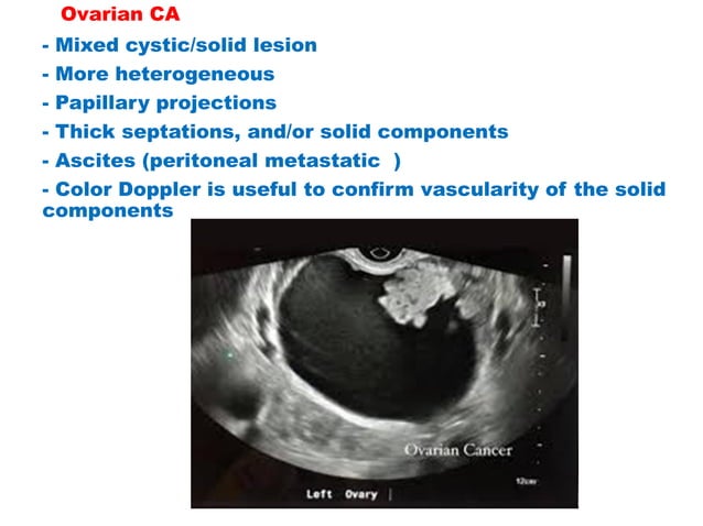 Gynecology Ultrasound PDF 11 (1). female pelvic ultrasound pdf | PPT