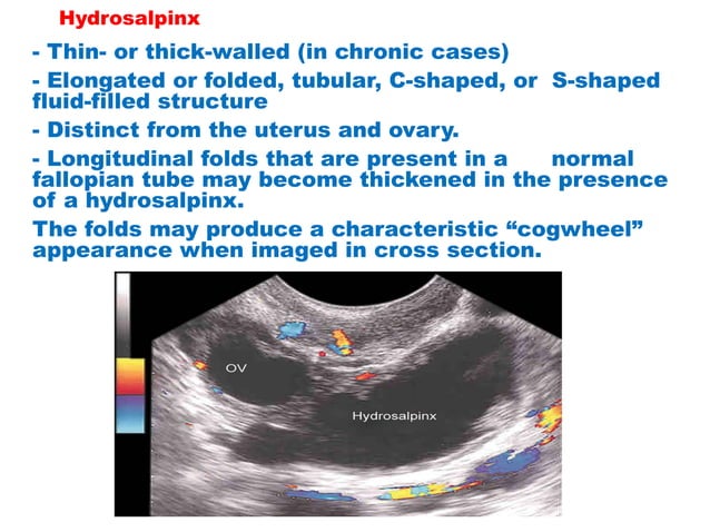 Gynecology Ultrasound PDF 11 (1). female pelvic ultrasound pdf | PPT