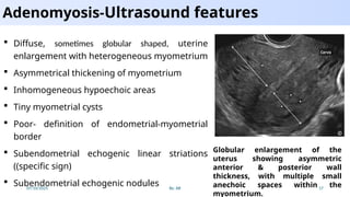 Ultrasound of gynecoloic pathologies.pptx