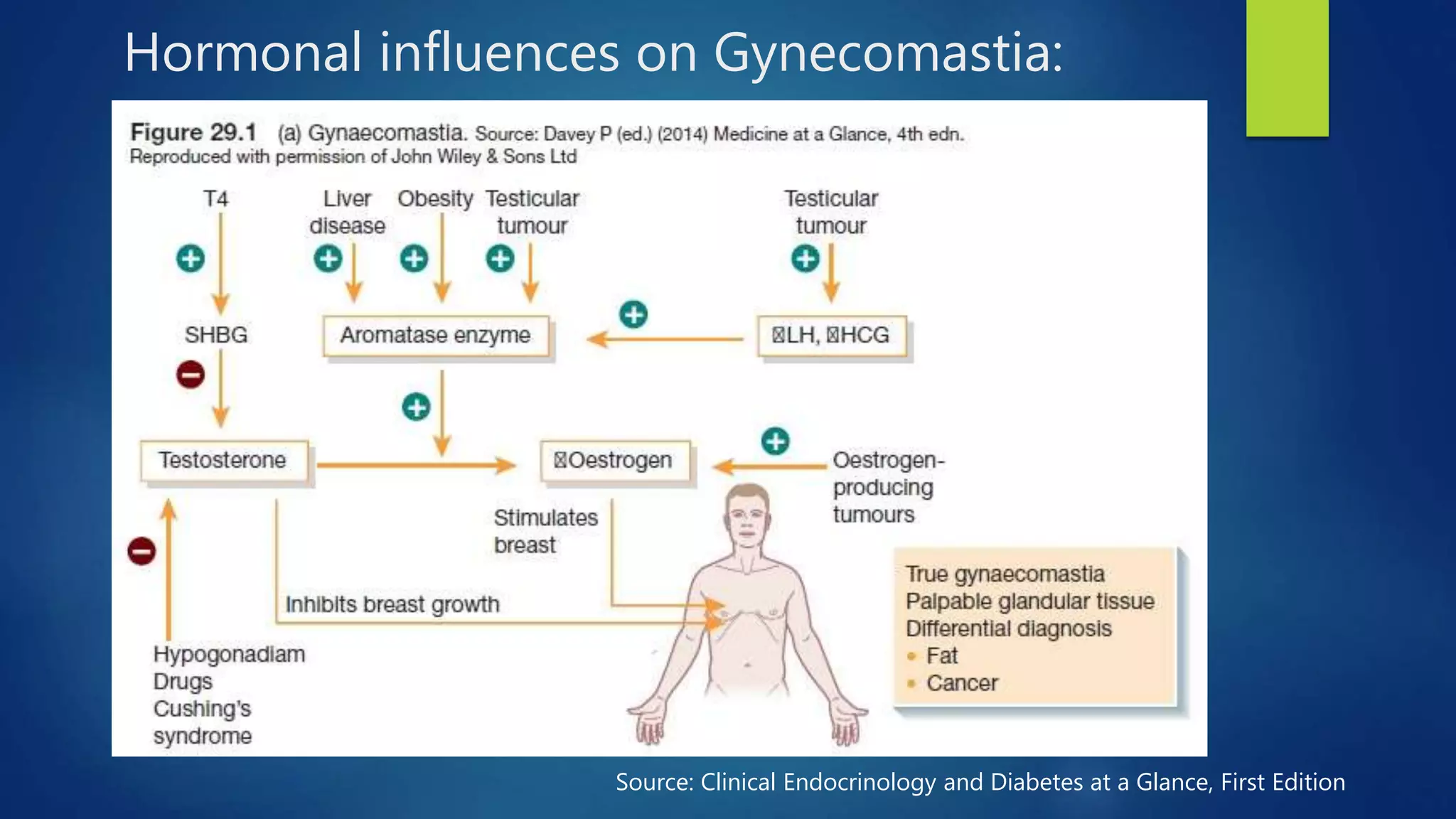 Gynecomastia | PPTX
