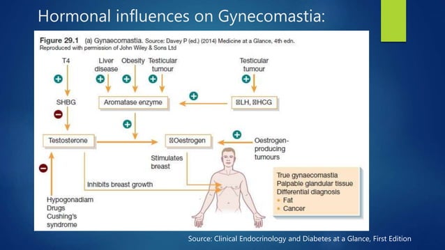 Gynecomastia | PPTX | Hormonal Disorders | Endocrine and Metabolic Diseases