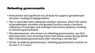 GYNECOMASTIA.pptx