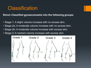 Gynecomastia final | PPTX