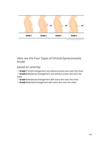 Gynecomastia surgery cost in hyderabad | PDF