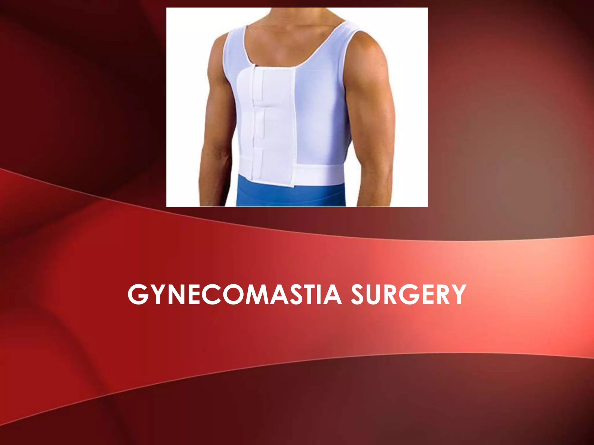 Gynecomastia surgery ppt | PPTX