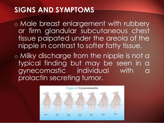 Gynecomastia Surgery Ppt
