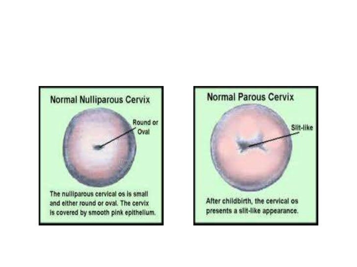 Gynae Hx taking and P/E by Dr Yay Mon