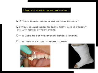 Gypsum | PDF