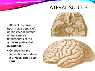 Lateral Sulcus