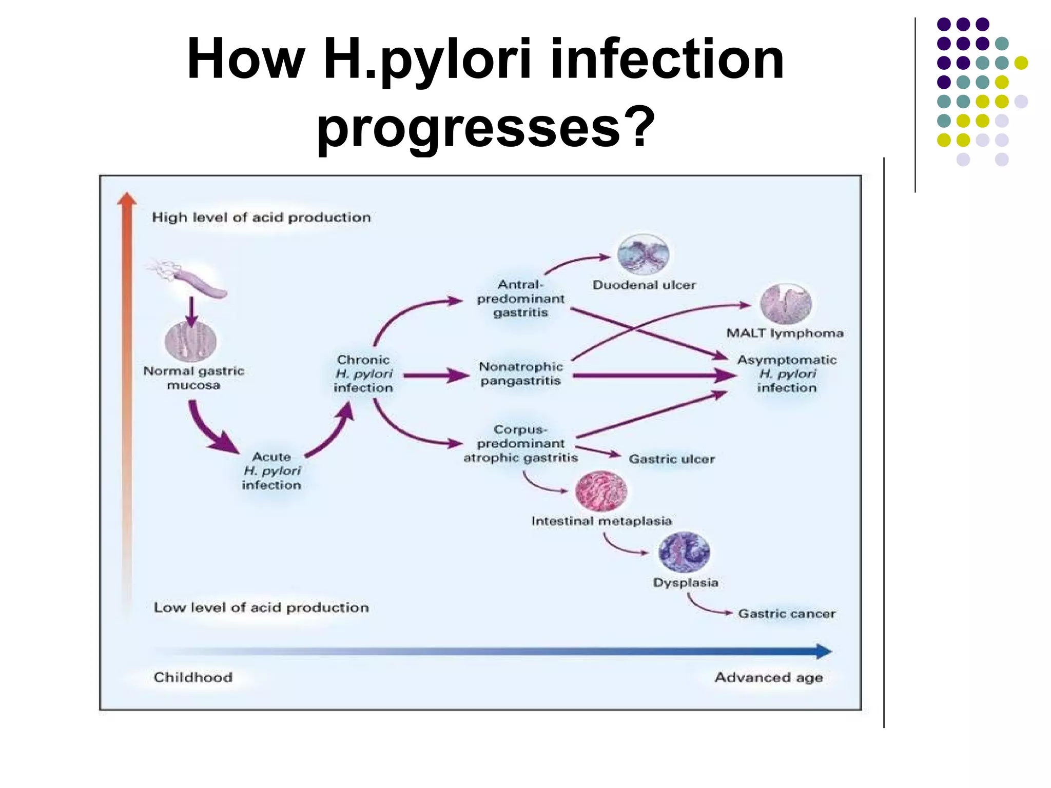 H. pylori | PPT