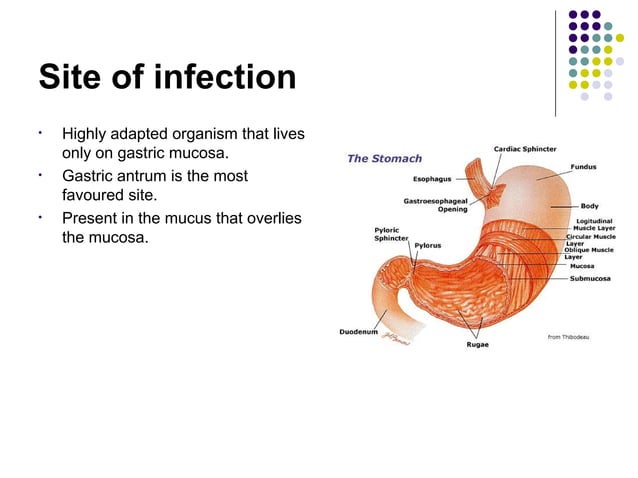 H. pylori | PPT | Digestive Disorders | Diseases and Conditions