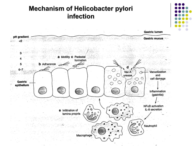 H. pylori | PPT | Digestive Disorders | Diseases and Conditions