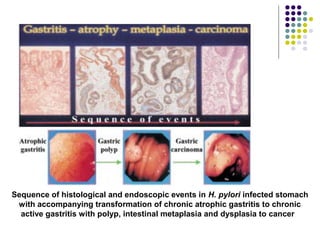H. pylori | PPT
