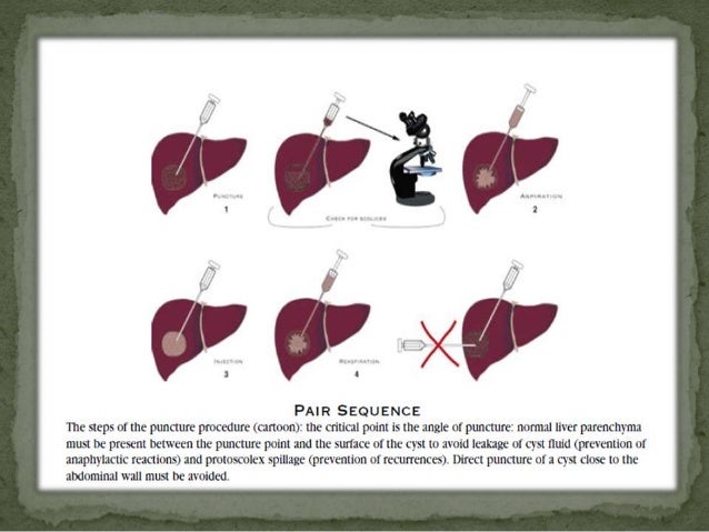 Hydatid cyst disaese