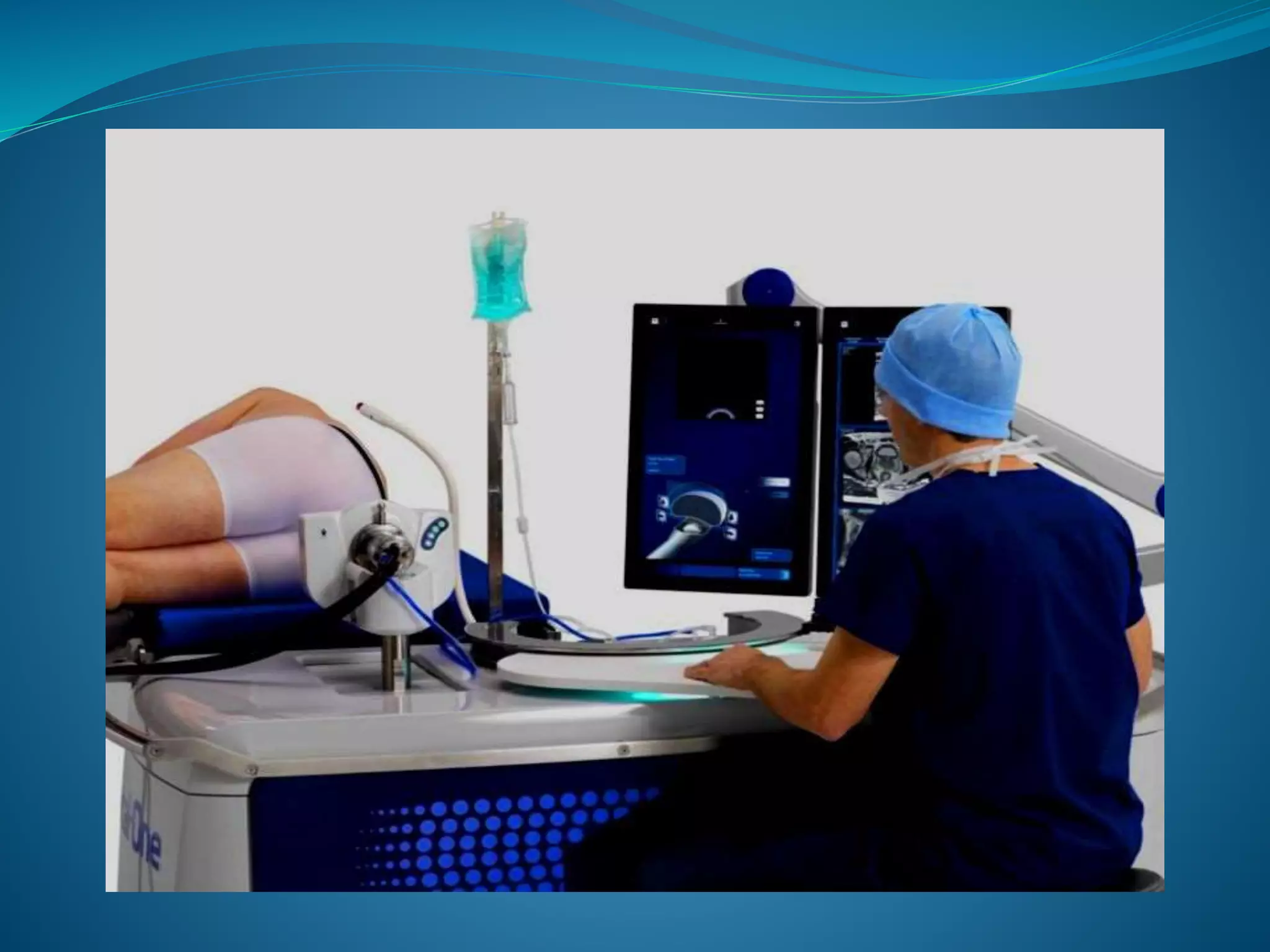 HIFU Technique of Prostate Cancer | PPTX