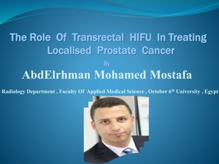 HIFU Technique of Prostate Cancer | PPTX