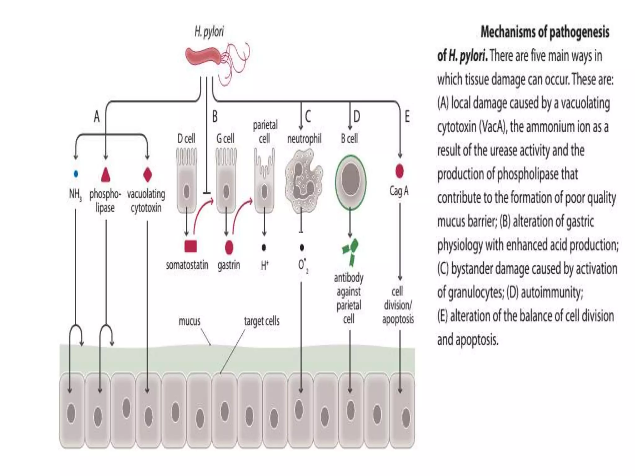 Helicobacter pylori and Peptic Ulcer disease | PPTX