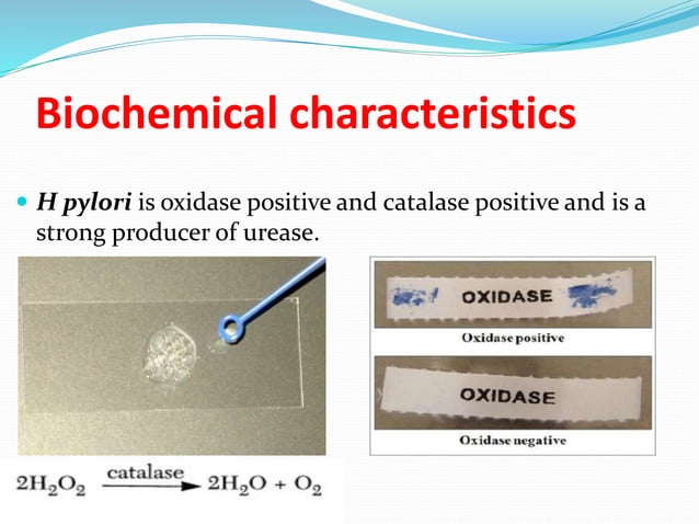 Helicobacter pylori and Peptic Ulcer disease | PPTX