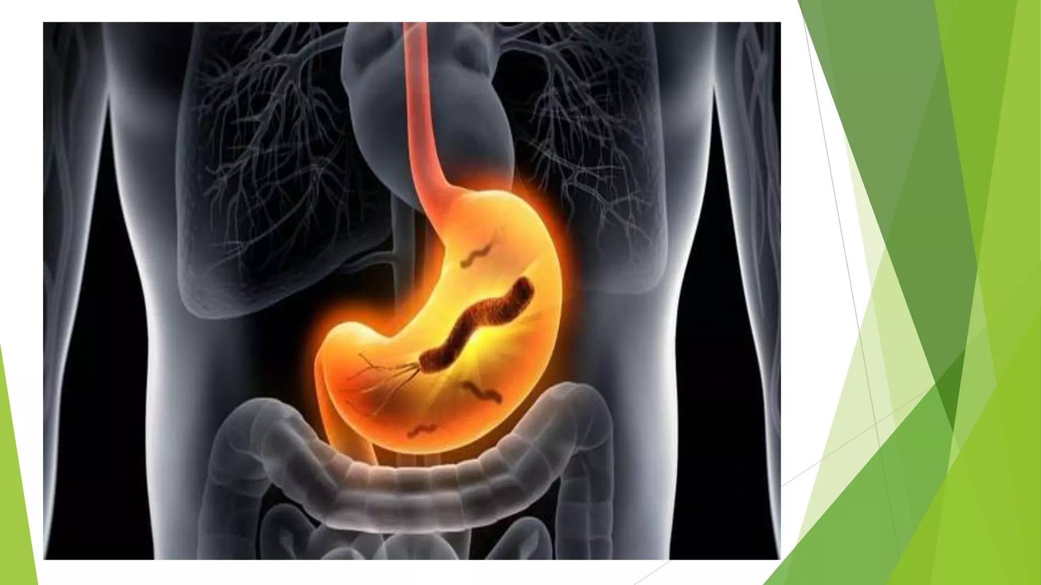 Helicobacter Pylori & Campylobacter bacteria. | PPT | Free download