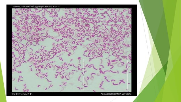Helicobacter Pylori & Campylobacter bacteria. | PPT | Free download