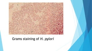 H. pylori | PPT