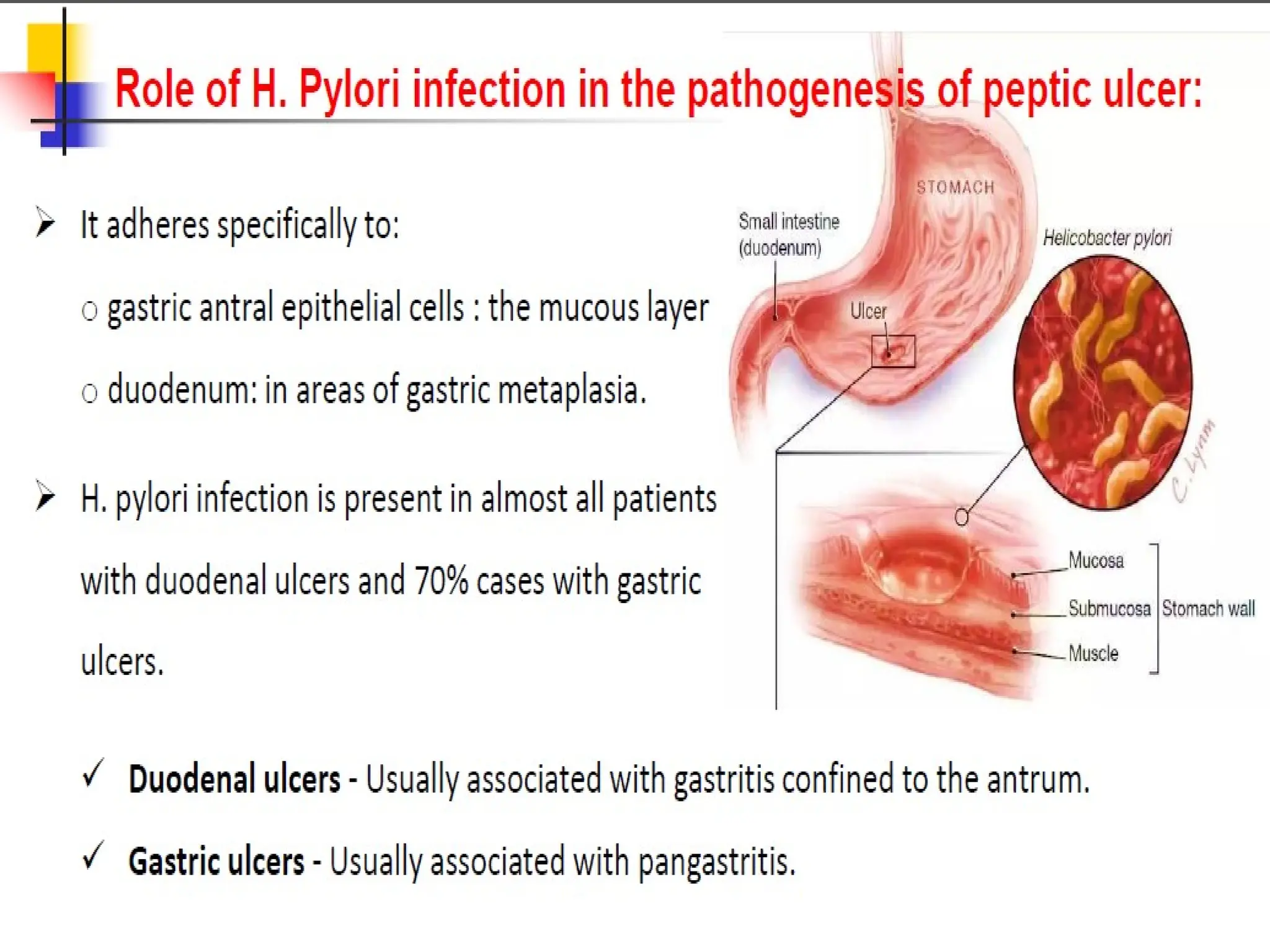 Presentation about H.pylori infection .pptx