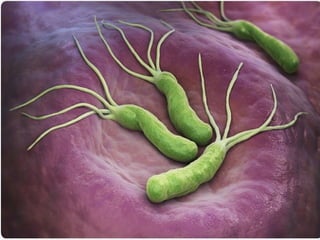 Presentation about H.pylori infection .pptx