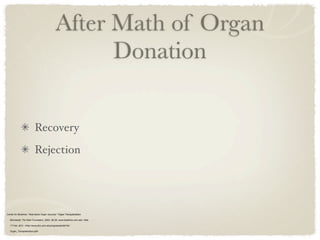 Organ Donation | KEY