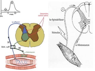 H reflex (Hoffmann's Reflex) | PPT