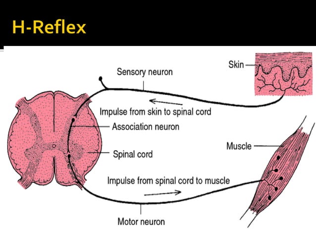 H reflex (Hoffmann's Reflex) | PPT