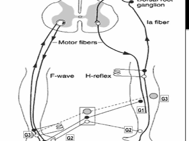 H reflex (Hoffmann's Reflex)